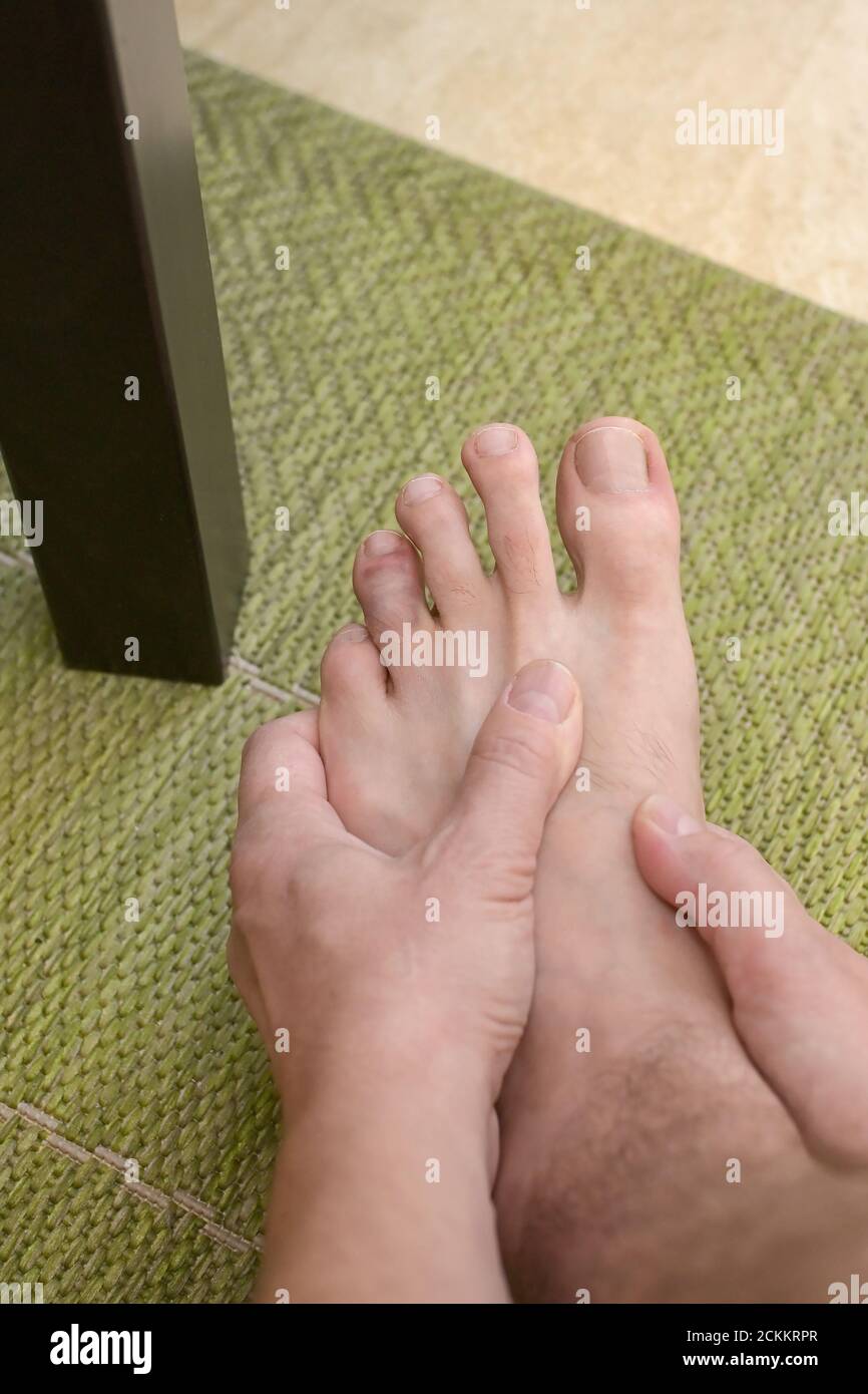 Finger man toe injured after kicking a table foot Stock Photo - Alamy