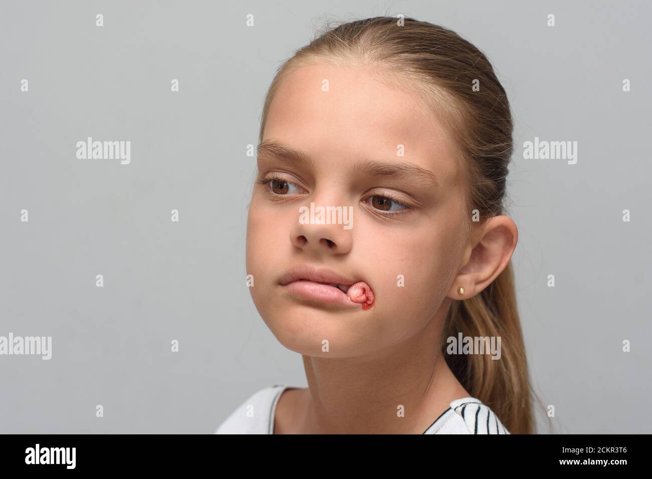 Pulled tooth blood hi-res stock photography and images - Alamy