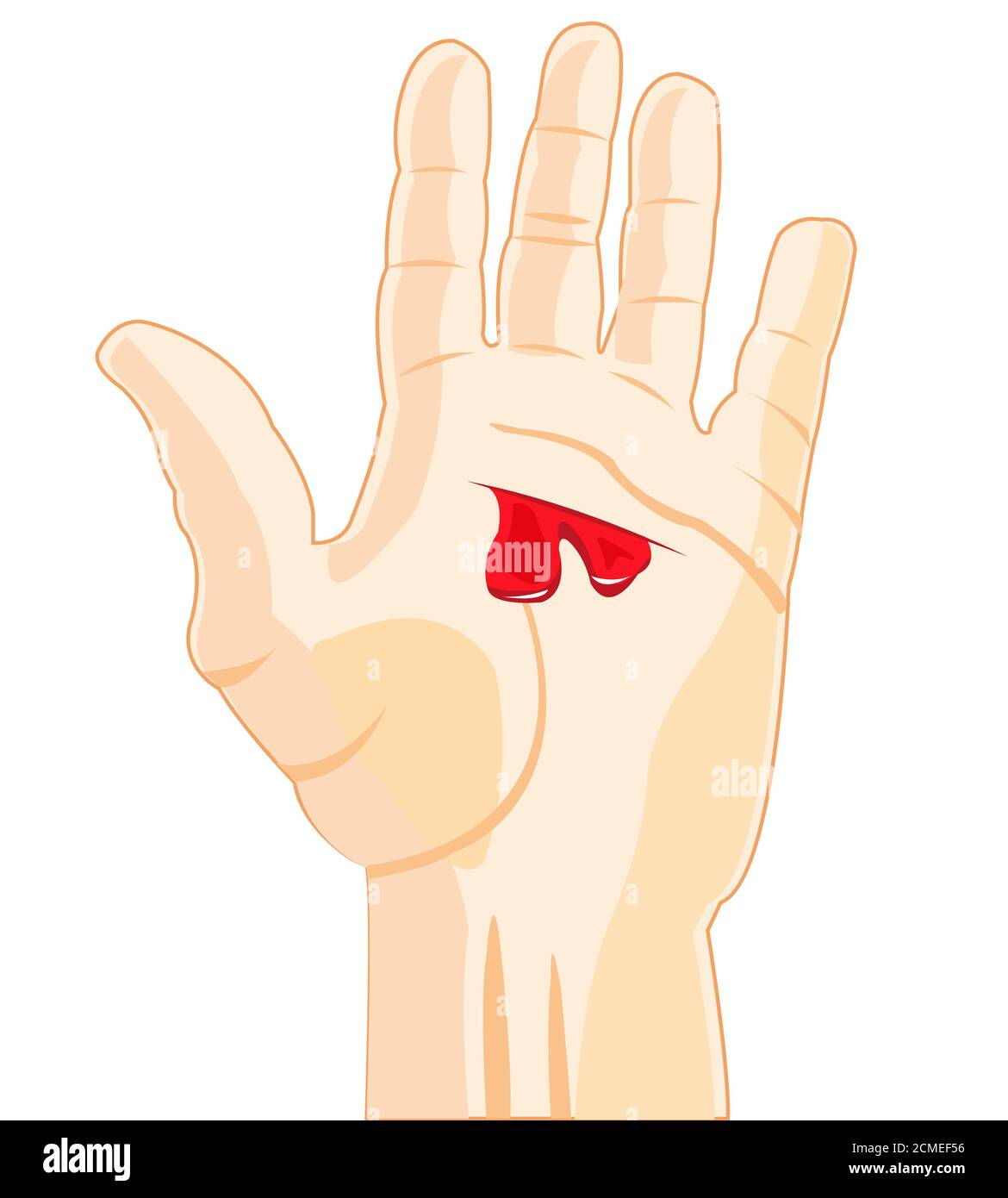 Haemorrhage hi-res stock photography and images - Alamy