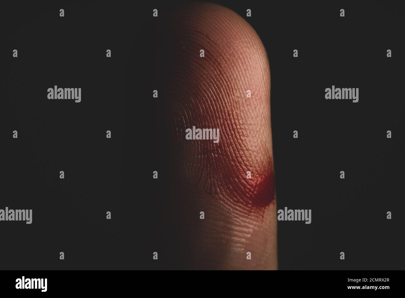 Cut finger hospital hi-res stock photography and images - Alamy