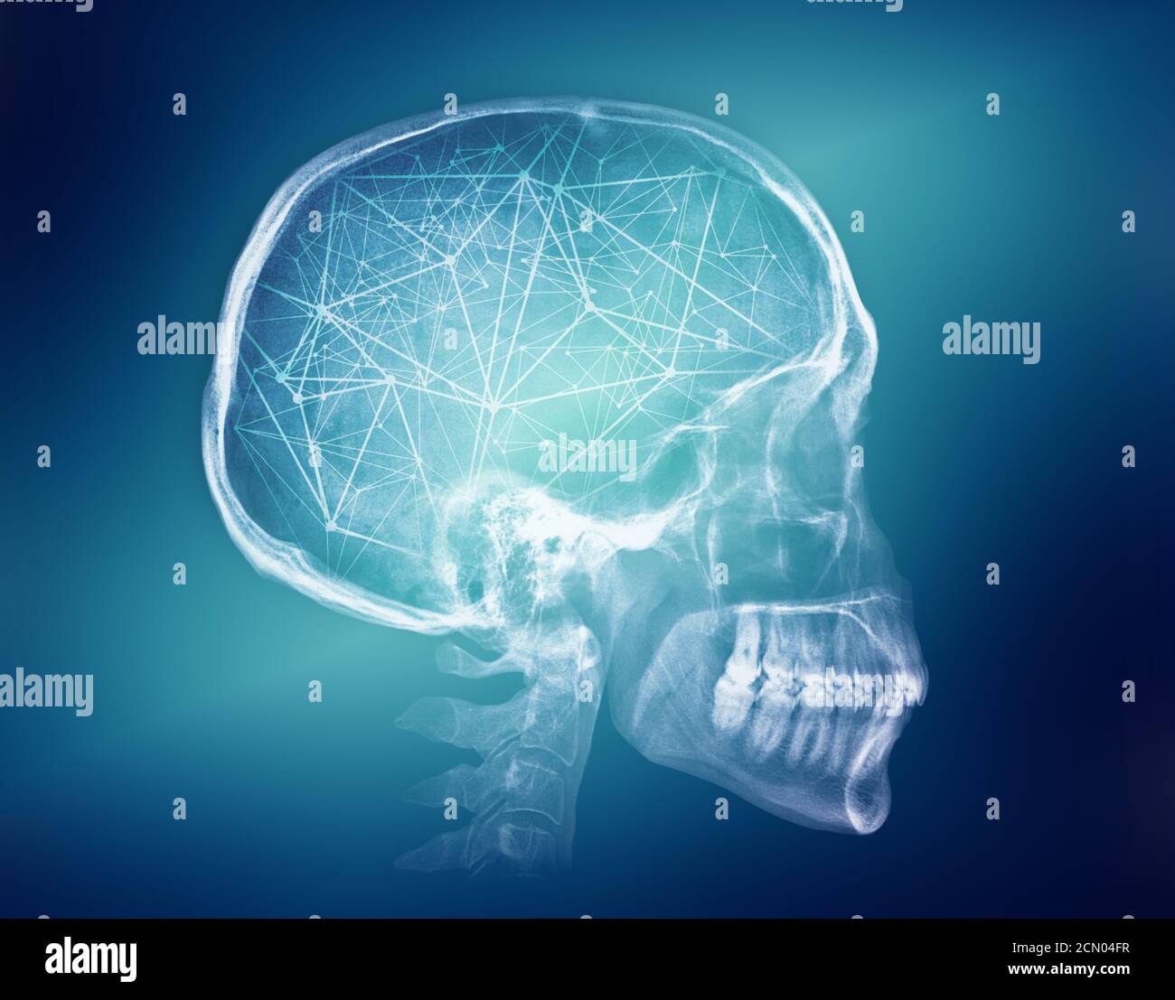 Human skull X-ray image. Artificial intelligence concept Stock Photo ...