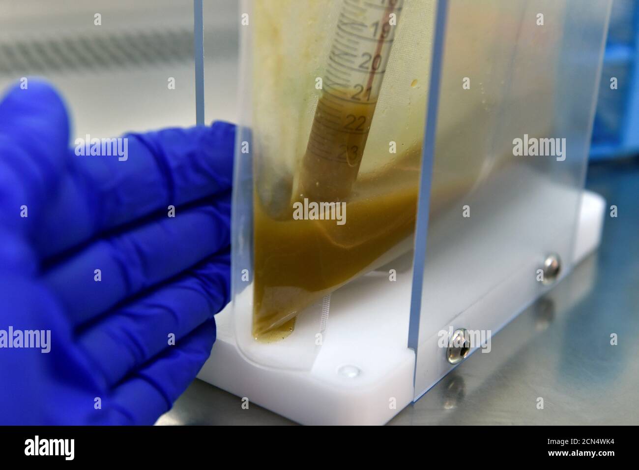 Faeces samples hi-res stock photography and images - Alamy