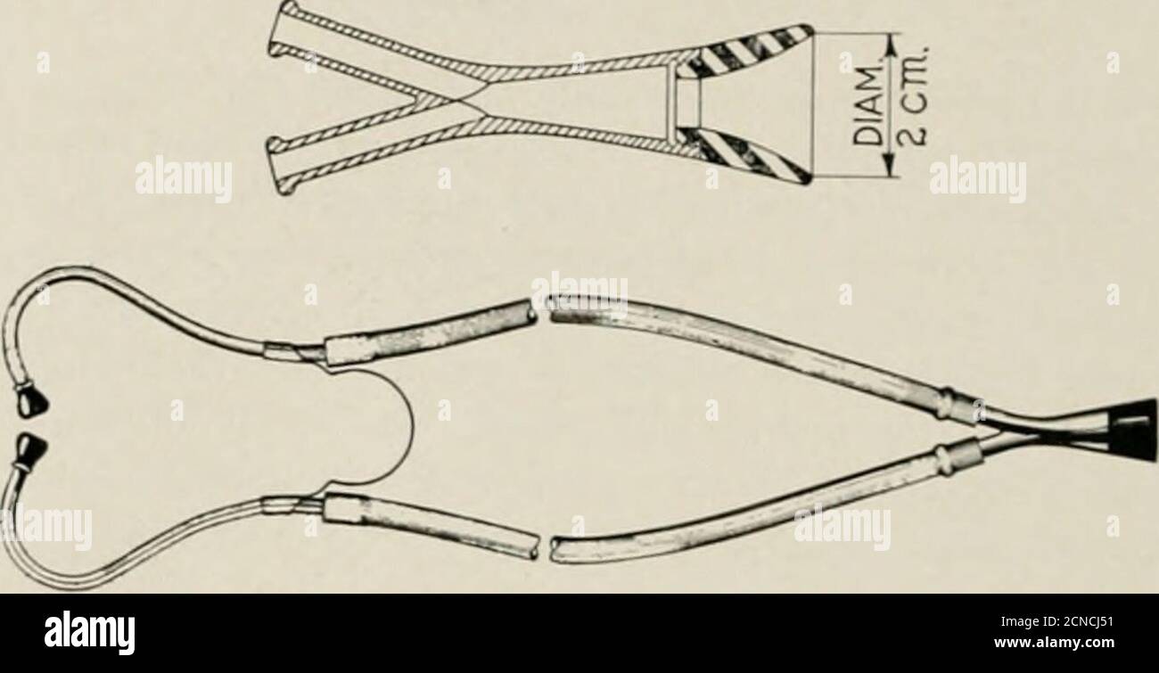 Windpipes hi-res stock photography and images - Alamy