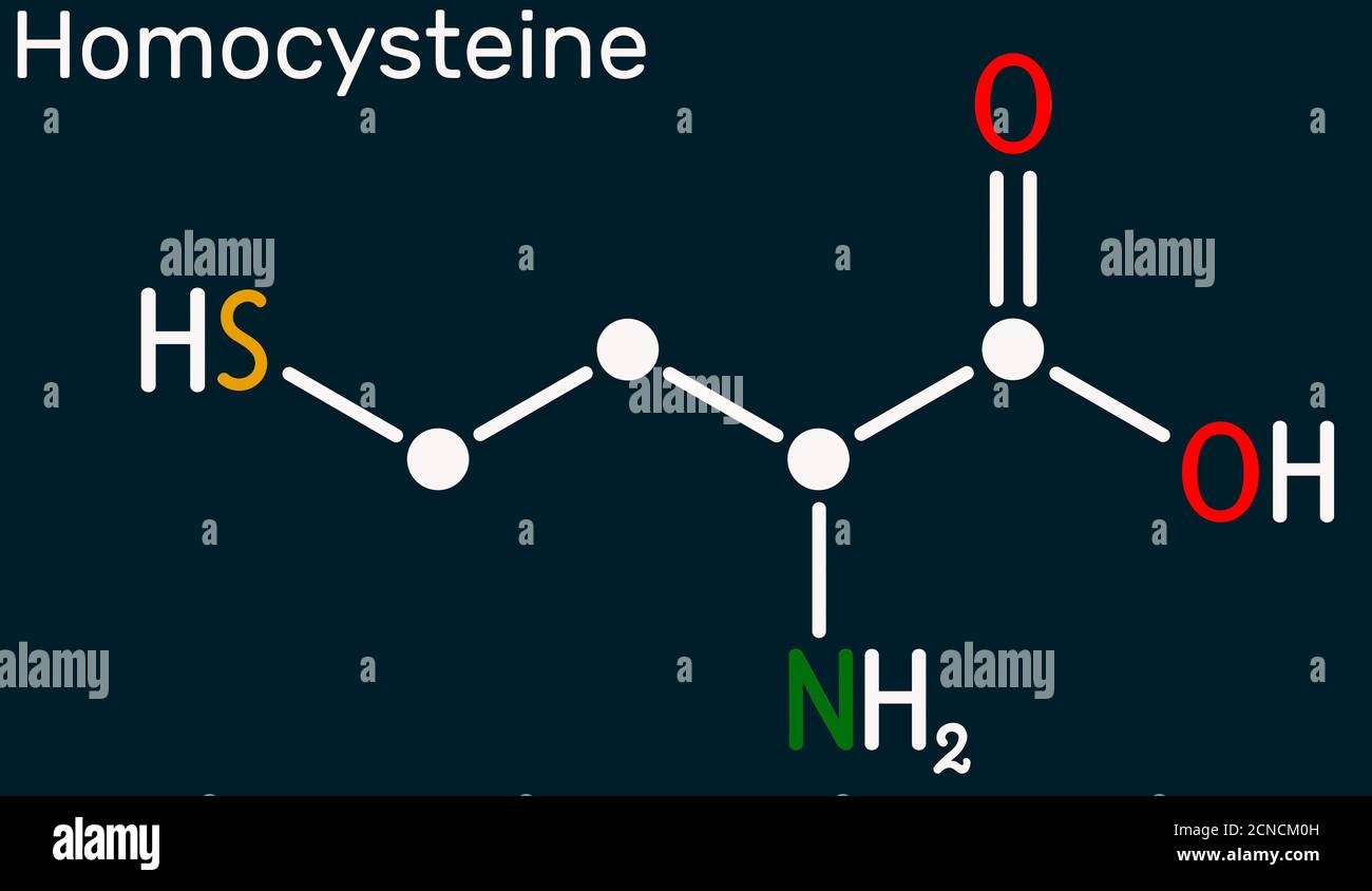 Homocysteine Structure