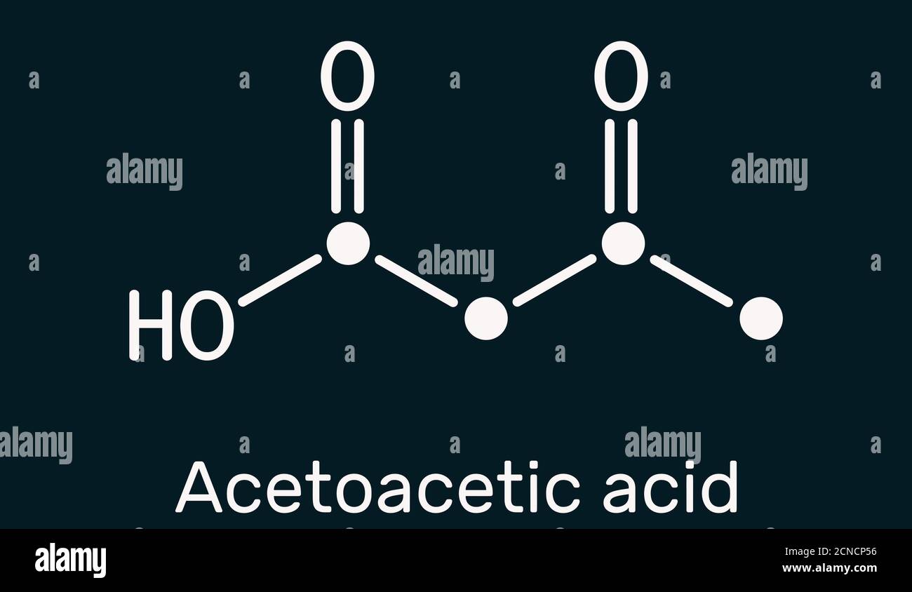 Acetoacetic acid, diacetic, oxobutanoic acid molecule. It is a ketone ...