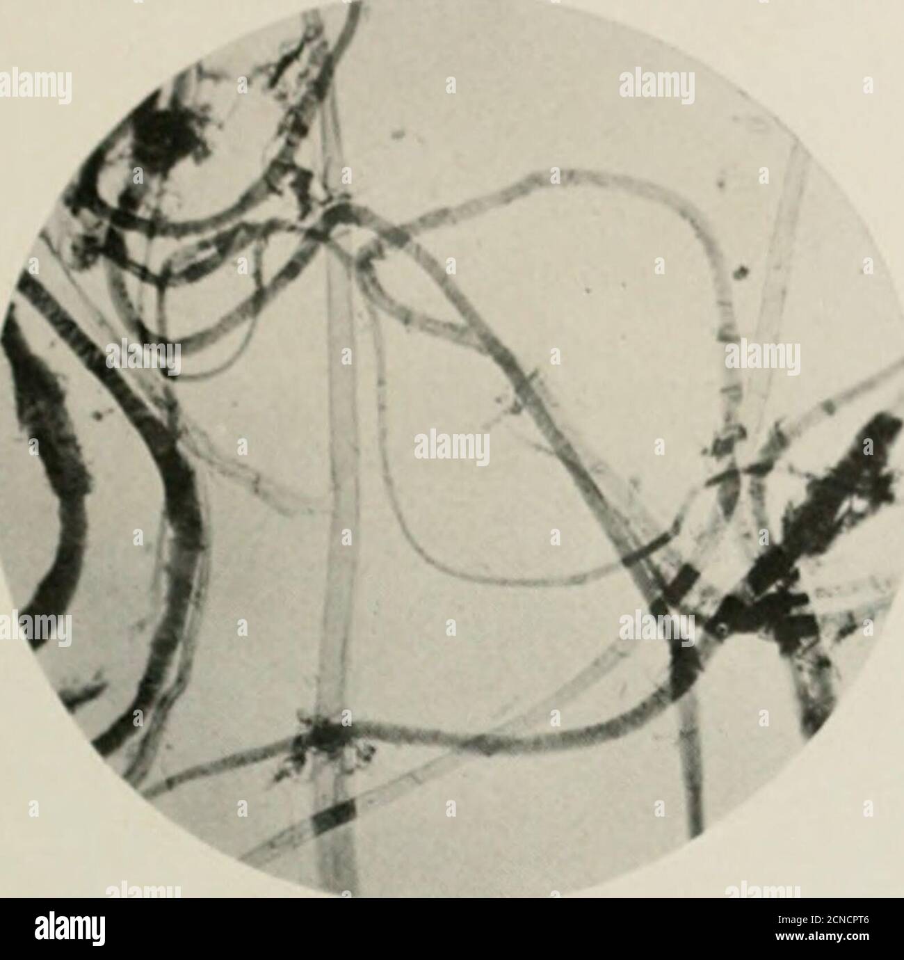 Ultra magnification hi-res stock photography and images - Alamy