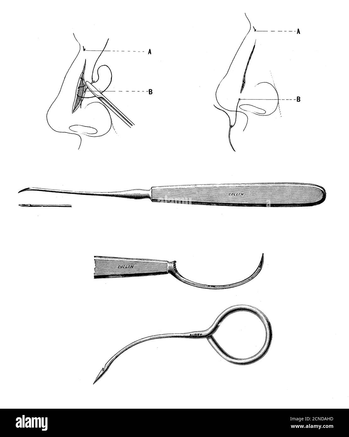 Healthcare and medicine: intracutaneous suture tools, vintage ...