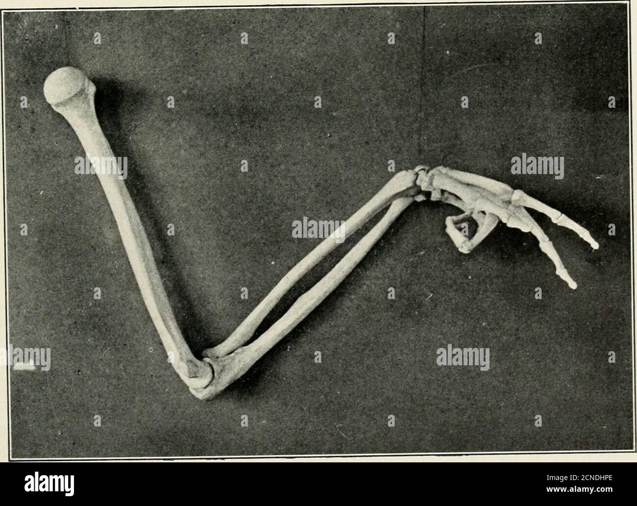 . The bird, its form and function . YiG, 70.—Skeleton of wing of Condor ...