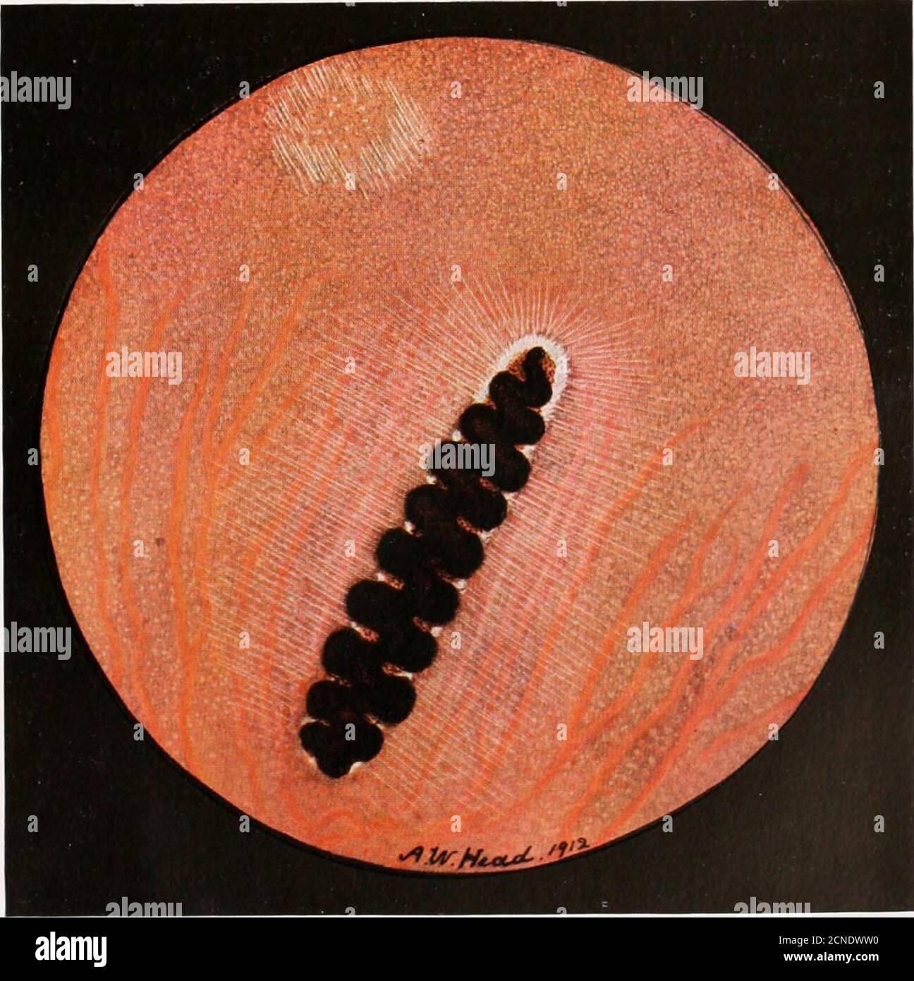 Eyeground hi-res stock photography and images - Alamy