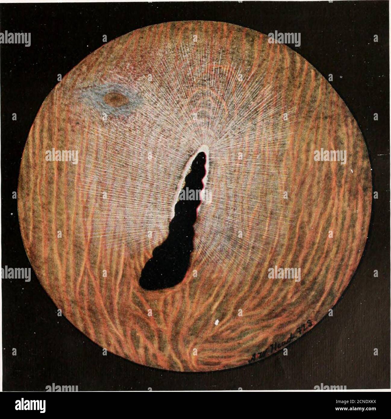 Eyeground hi-res stock photography and images - Alamy