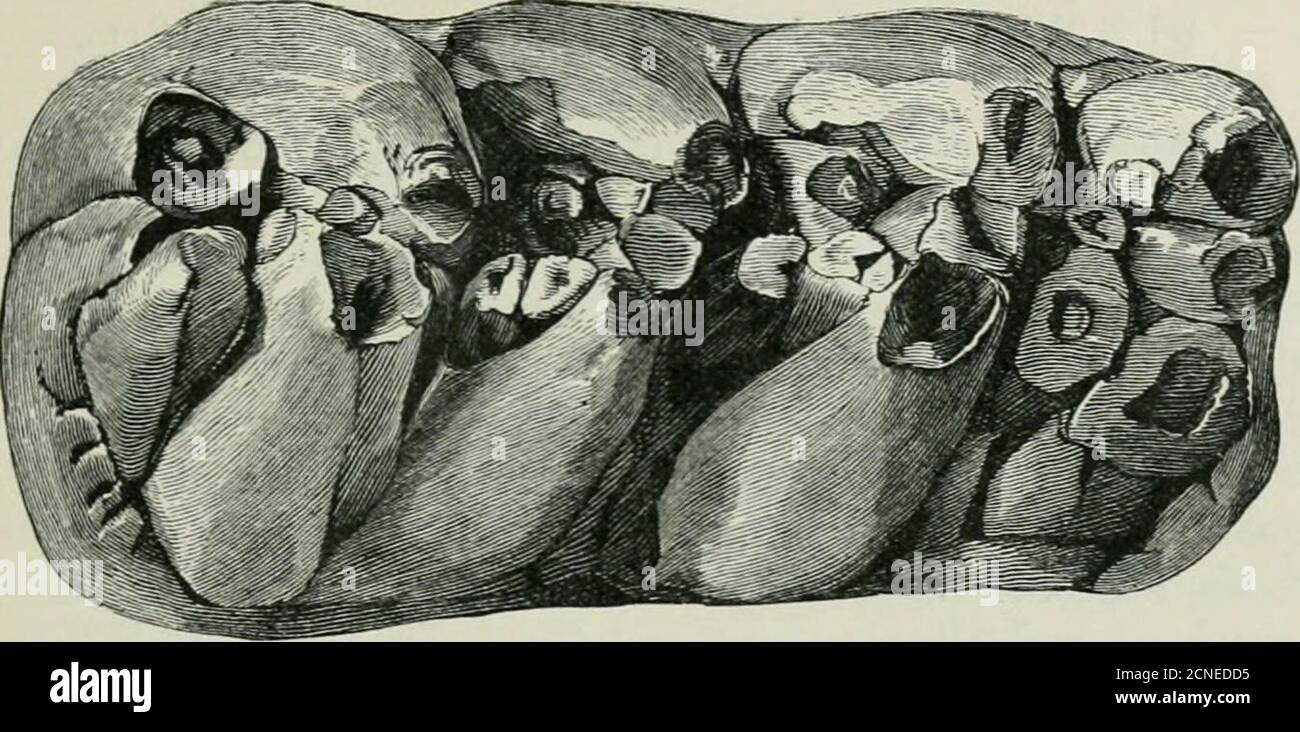 Molar tooth cross section hi-res stock photography and images - Alamy