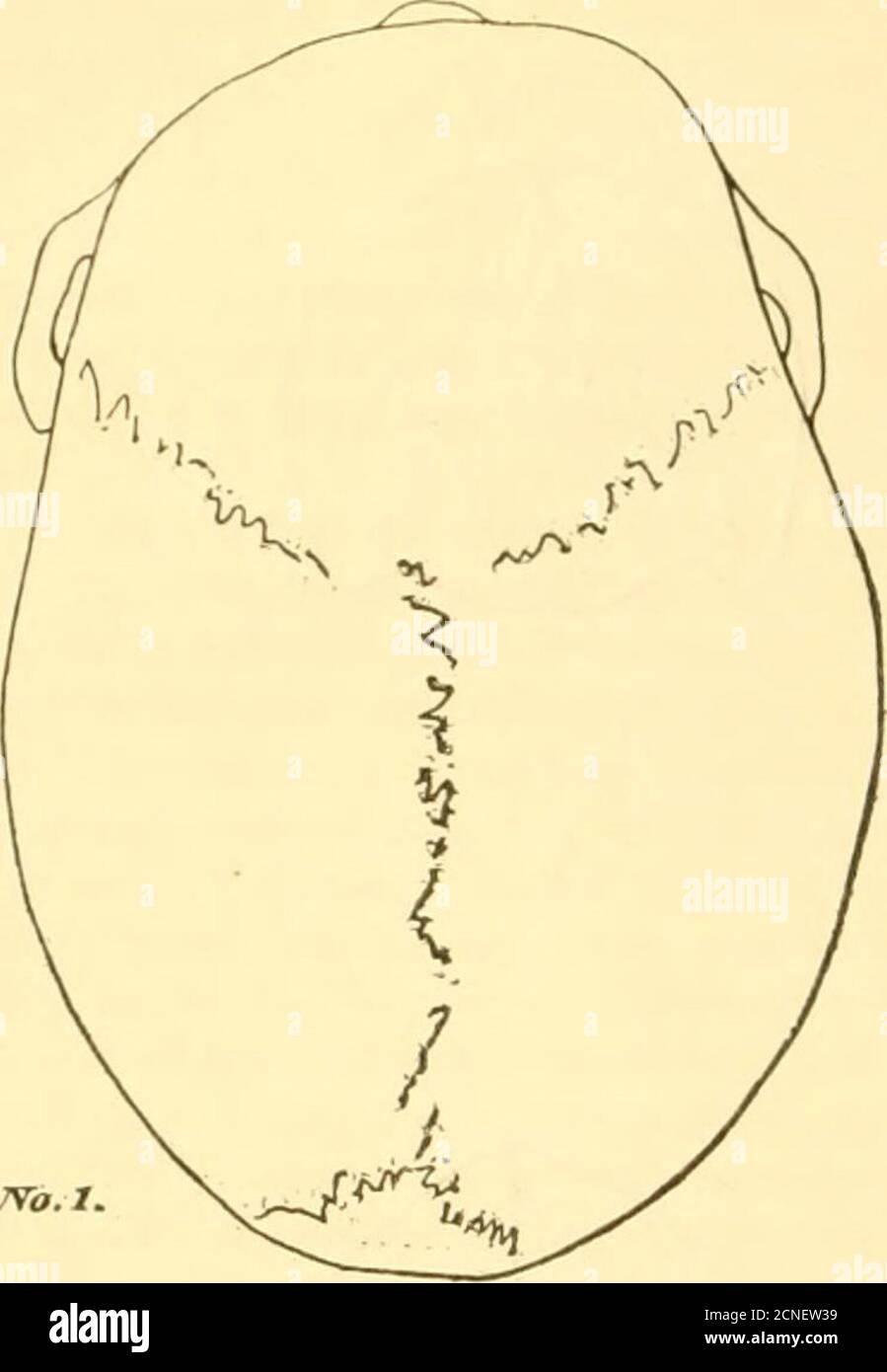 Dolichocephalic hi-res stock photography and images - Alamy