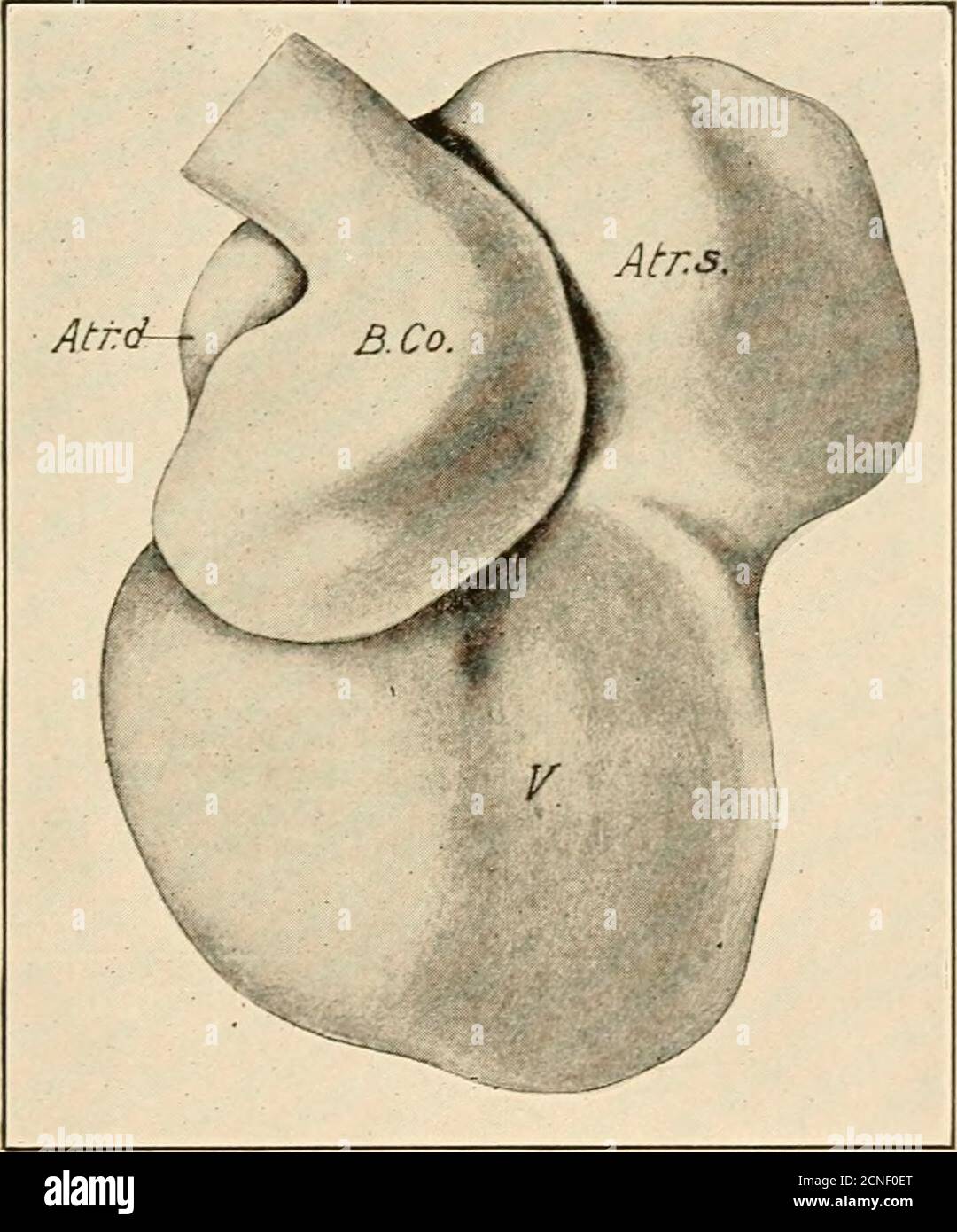 Left lateral view of the heart hi-res stock photography and images - Alamy