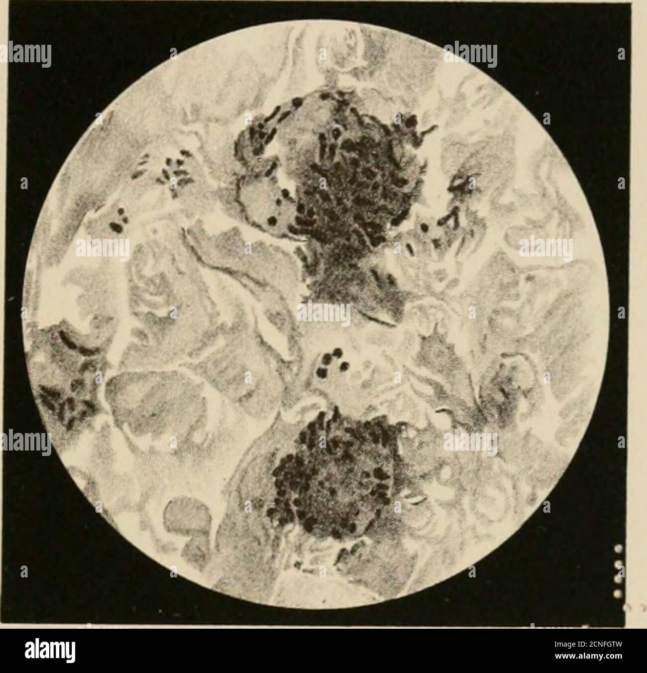 . The etiology and pathology of grouse disease, fowl enteritis, and ...