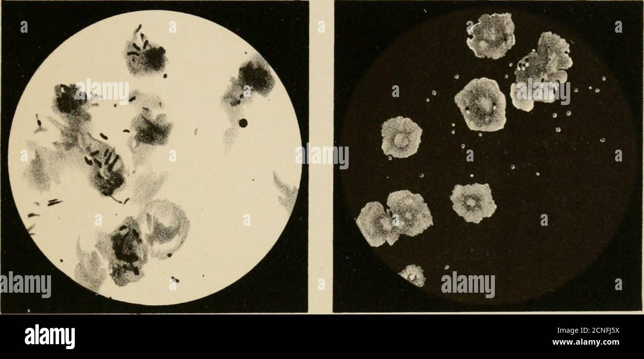 . The etiology and pathology of grouse disease, fowl enteritis, and ...