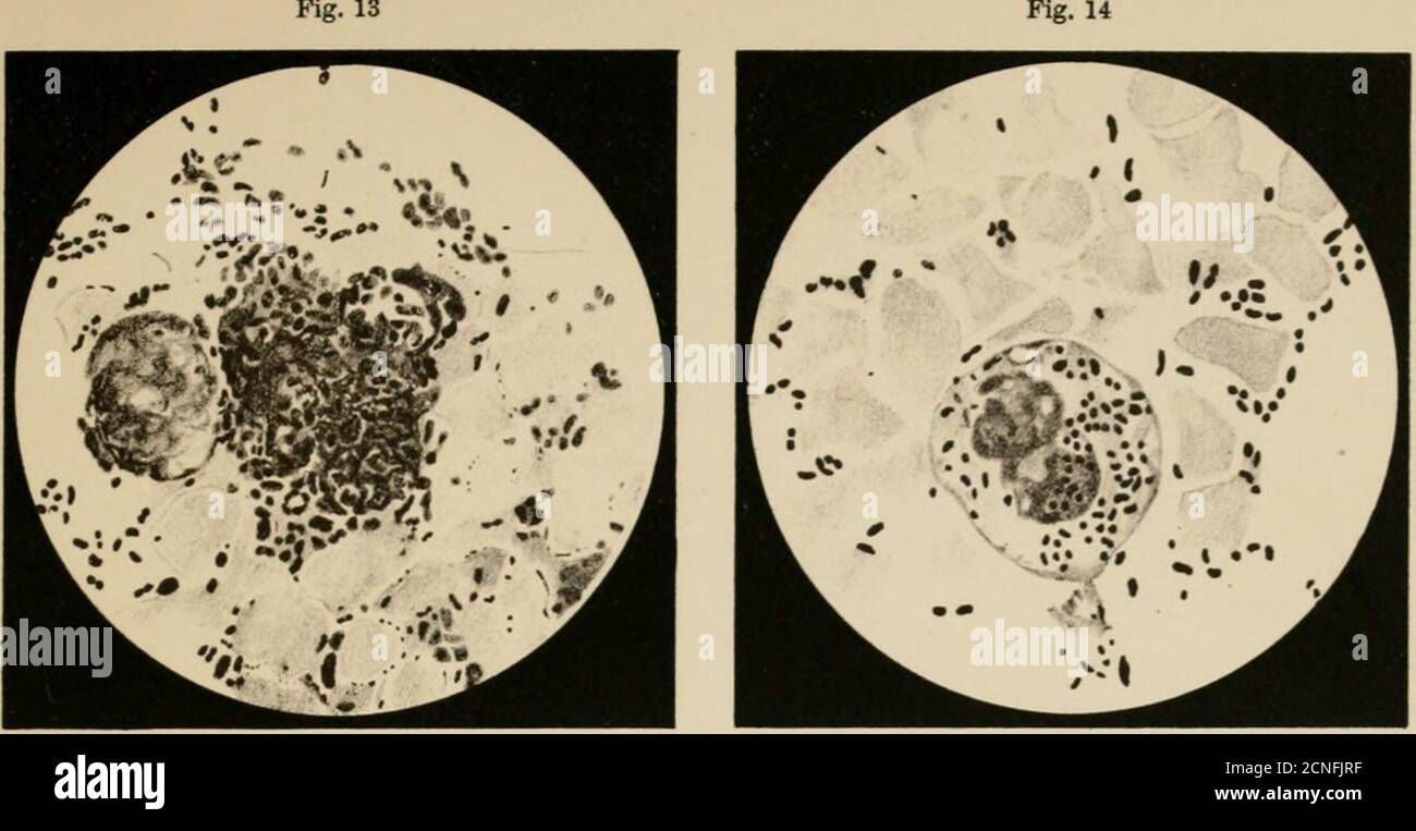 . The etiology and pathology of grouse disease, fowl enteritis, and ...