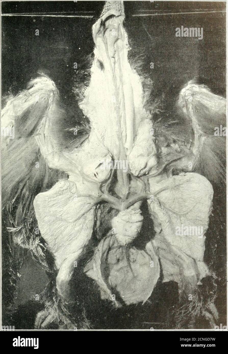 Artery leading to heart hi-res stock photography and images - Alamy