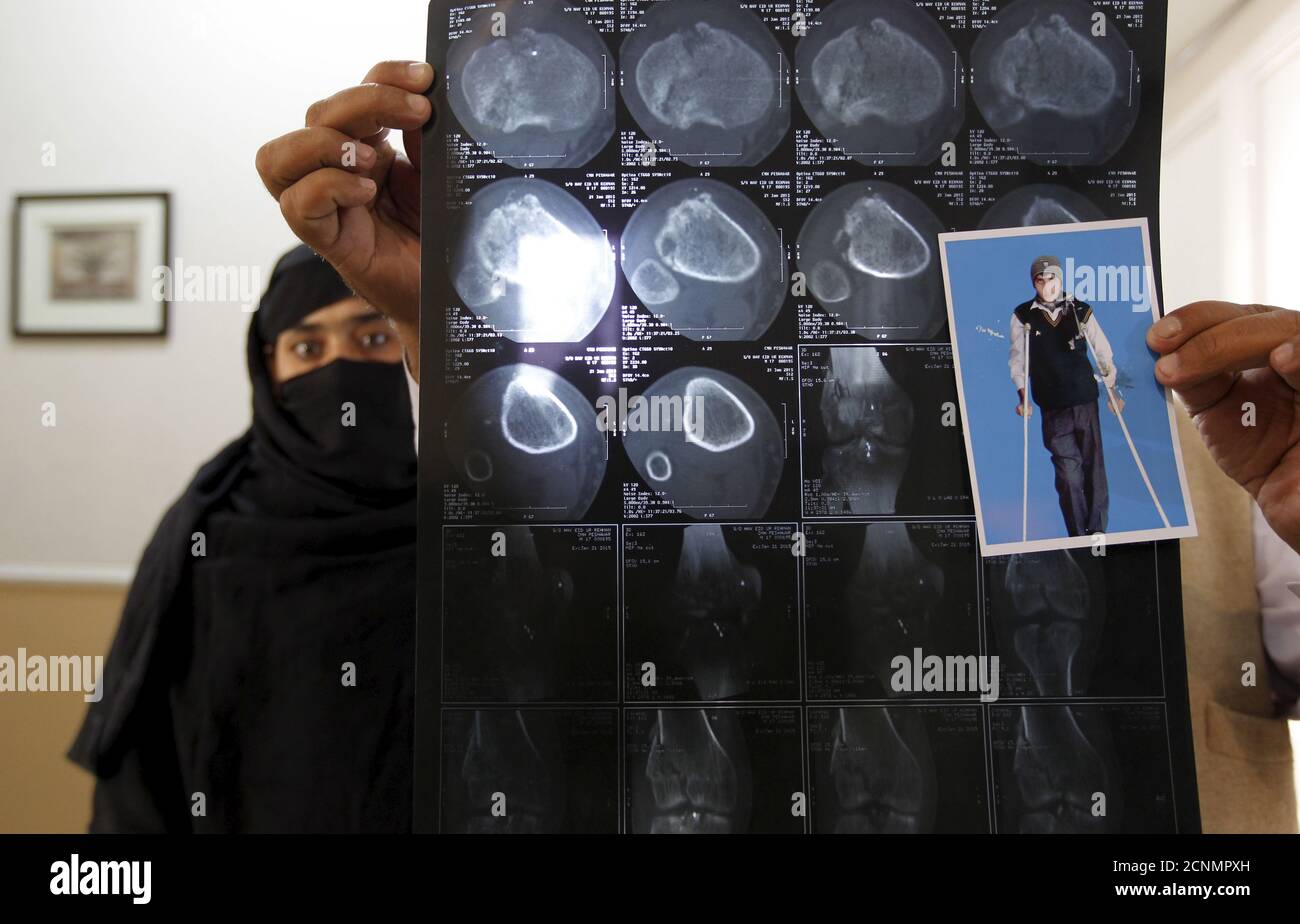 Bullet fragments hi-res stock photography and images - Alamy