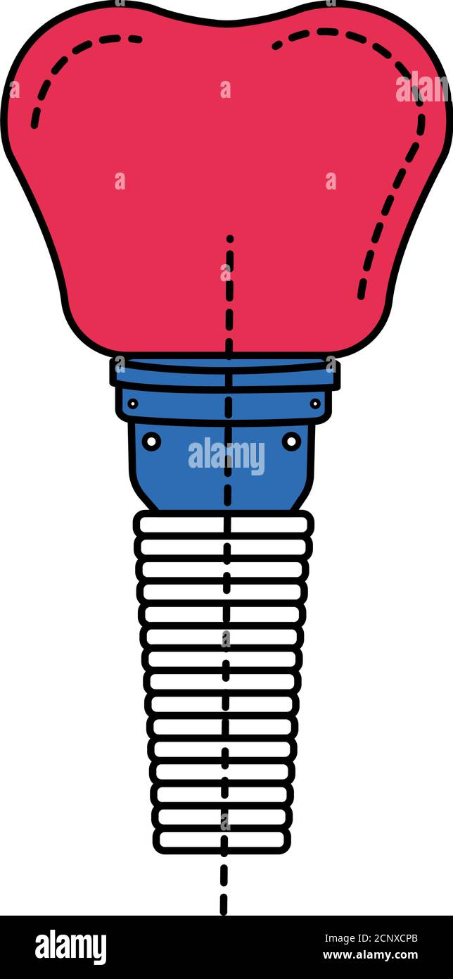 Dental implant tooth color line icon. Metal post that replaces the root ...