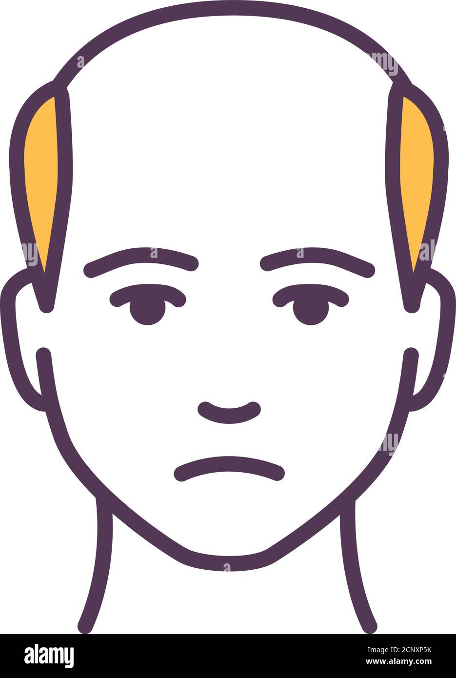 Man with a bald head color line icon. Baldness stage. Alopecia ...