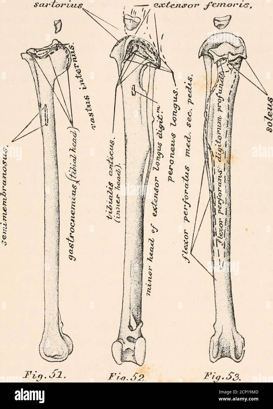 . The myology of the raven (Corvus corax sinuatus.) A guide to the ...