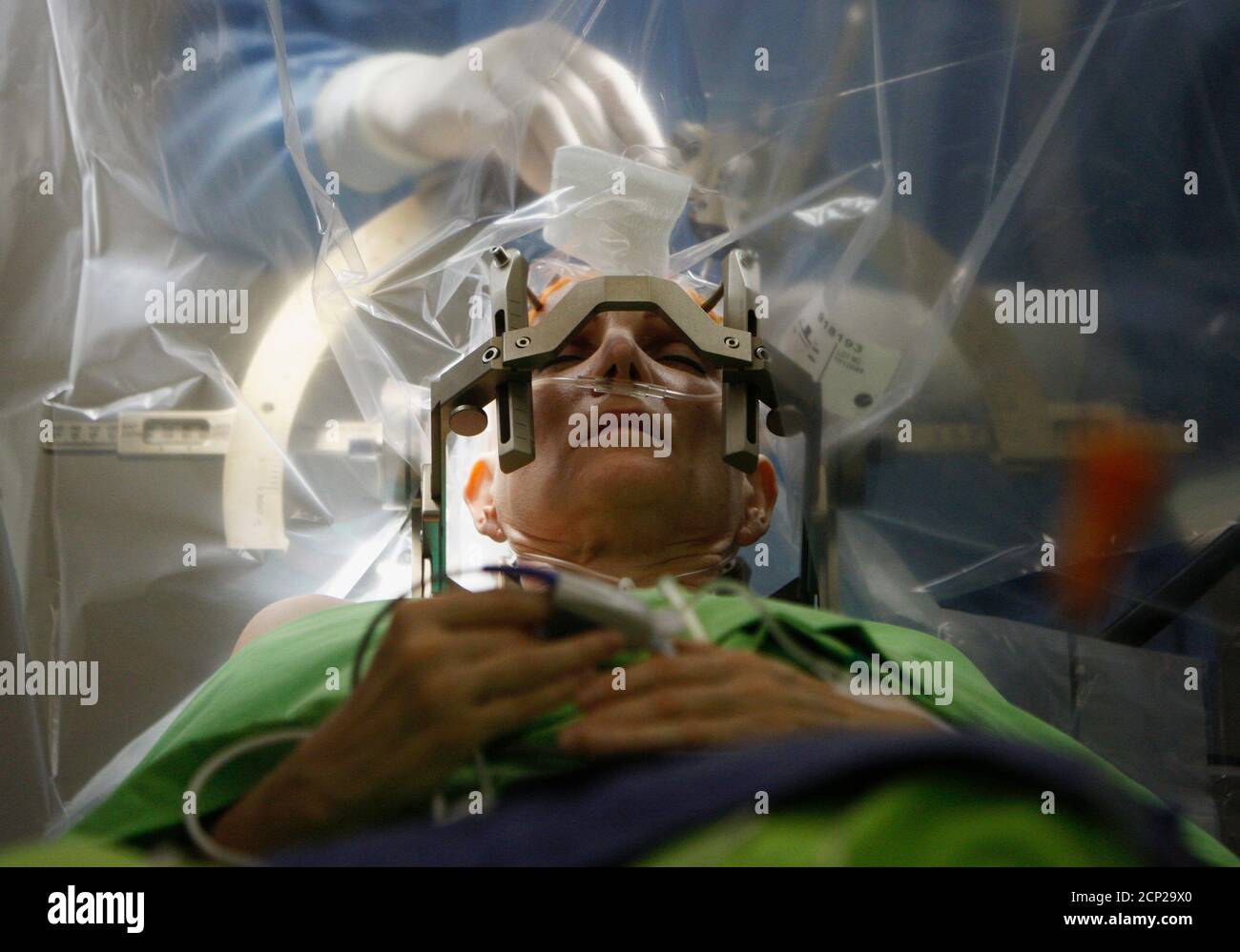 Awake surgery hi-res stock photography and images - Alamy