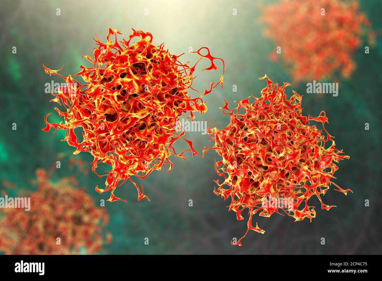 Cancer cells, computer illustration Stock Photo - Alamy