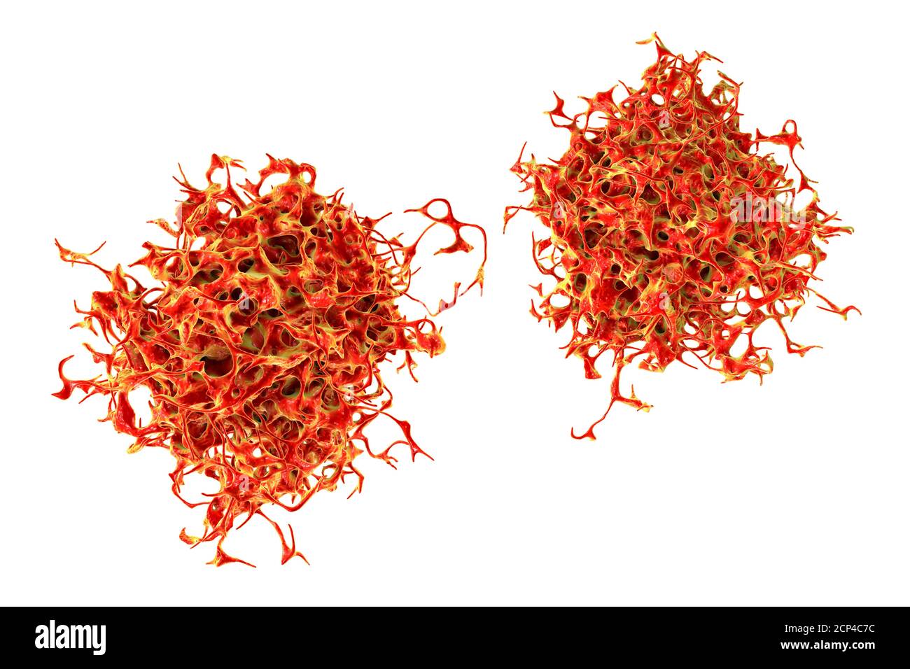 Cancer cells, computer illustration Stock Photo - Alamy