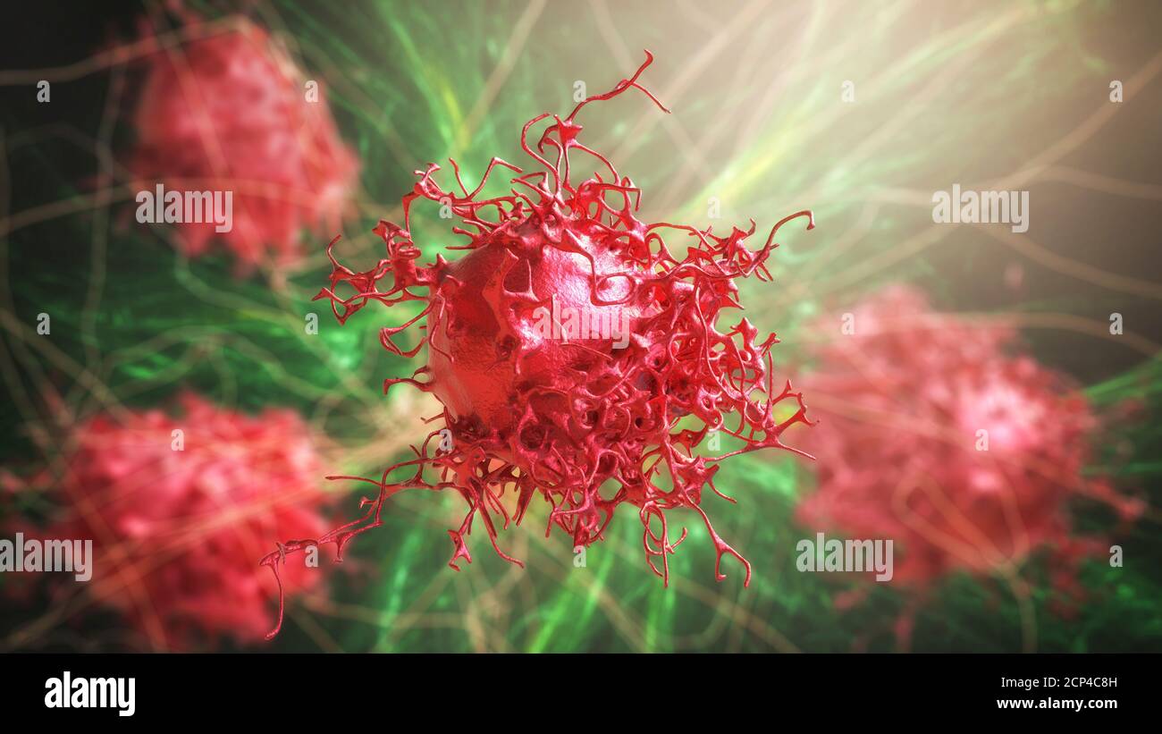 Cervical cancer cells, computer illustration Stock Photo - Alamy