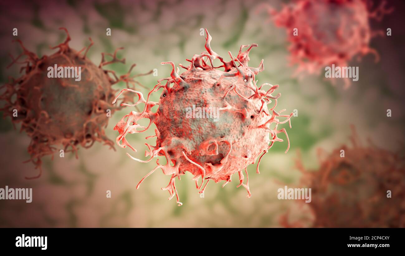 Skin cancer cell, computer illustration Stock Photo - Alamy