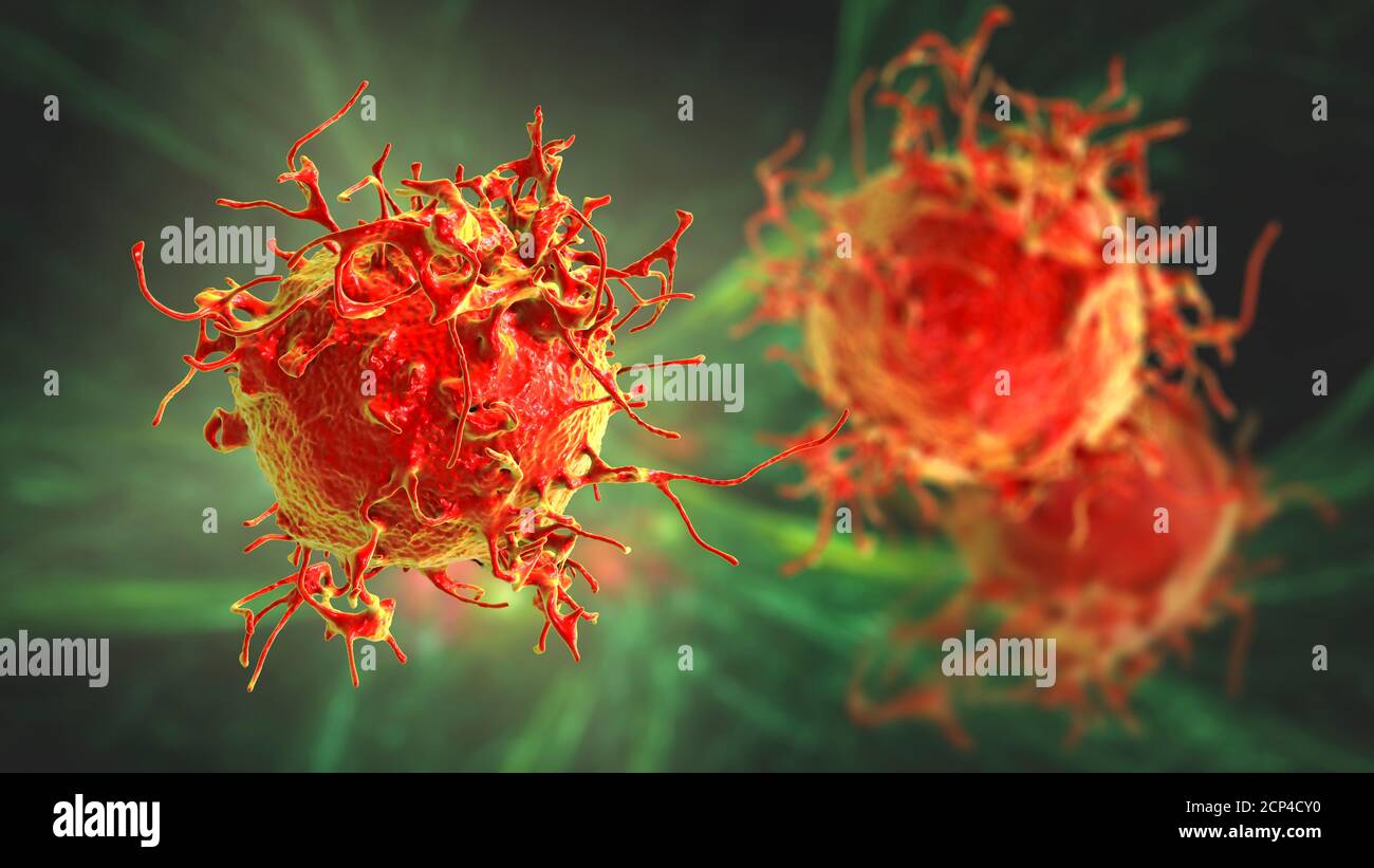Skin cancer cell, computer illustration Stock Photo - Alamy