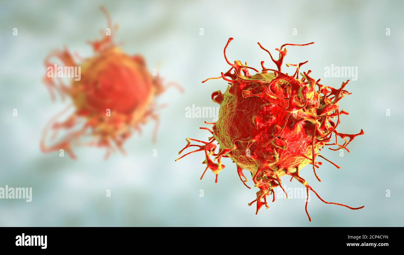 Skin cancer cell, computer illustration Stock Photo - Alamy