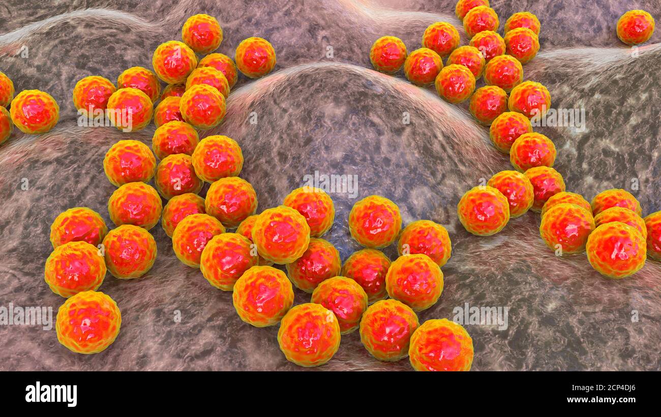 Computer illustration of staphylococci bacteria (Staphylococcus aureus ...