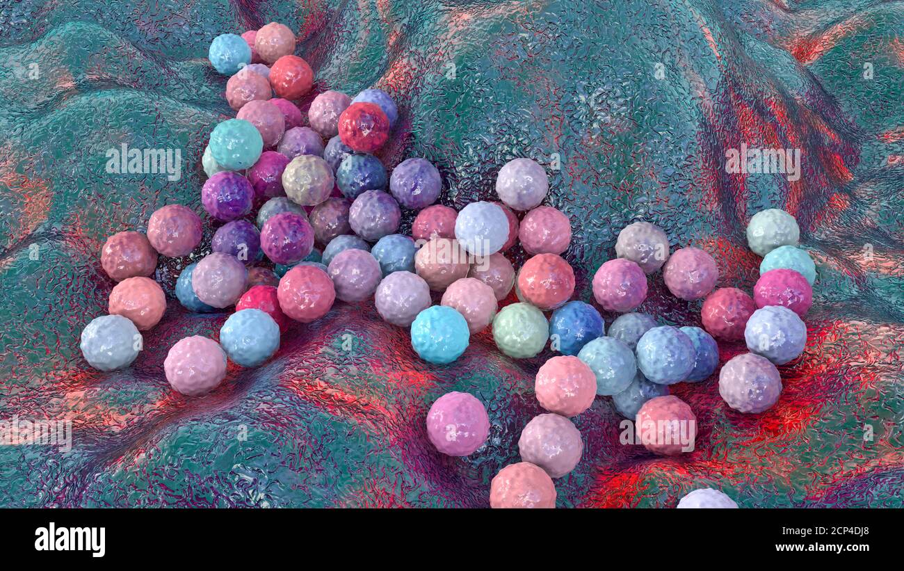 Computer illustration of staphylococci bacteria (Staphylococcus aureus ...