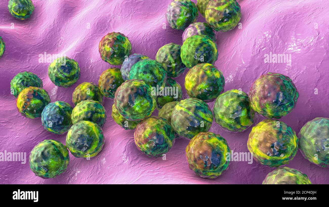 Computer illustration of staphylococci bacteria (Staphylococcus aureus ...