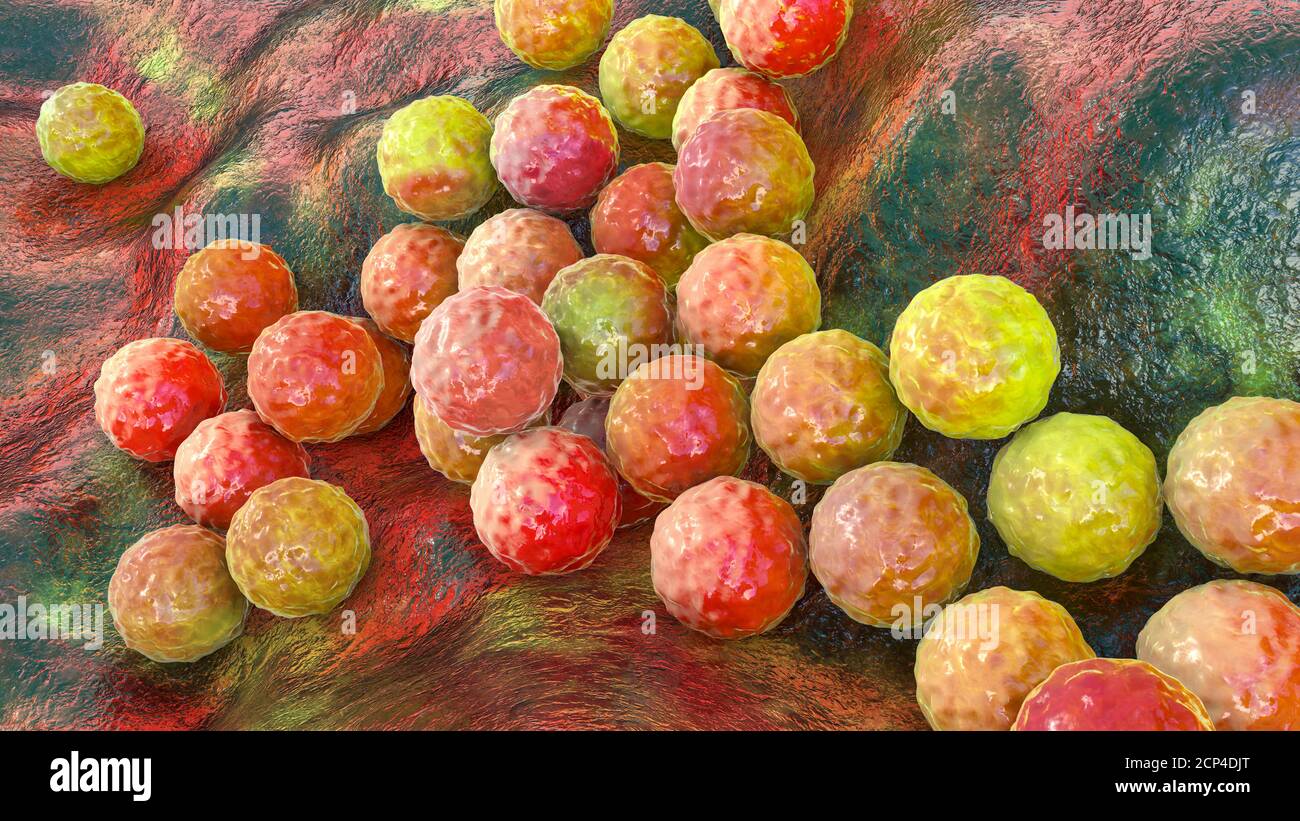 Computer illustration of staphylococci bacteria (Staphylococcus aureus ...