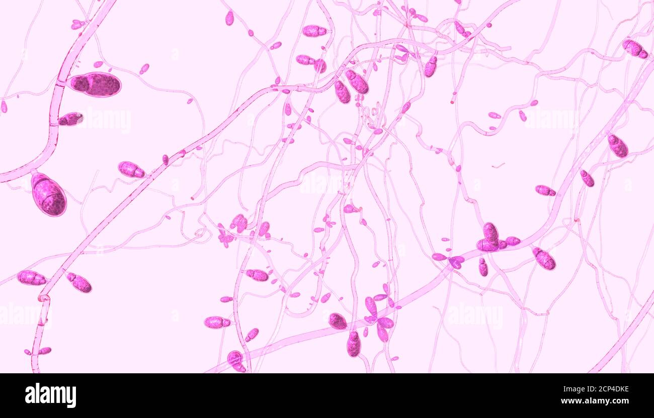 Close-up of growing dermatophyte fungus, illustration Stock Photo - Alamy