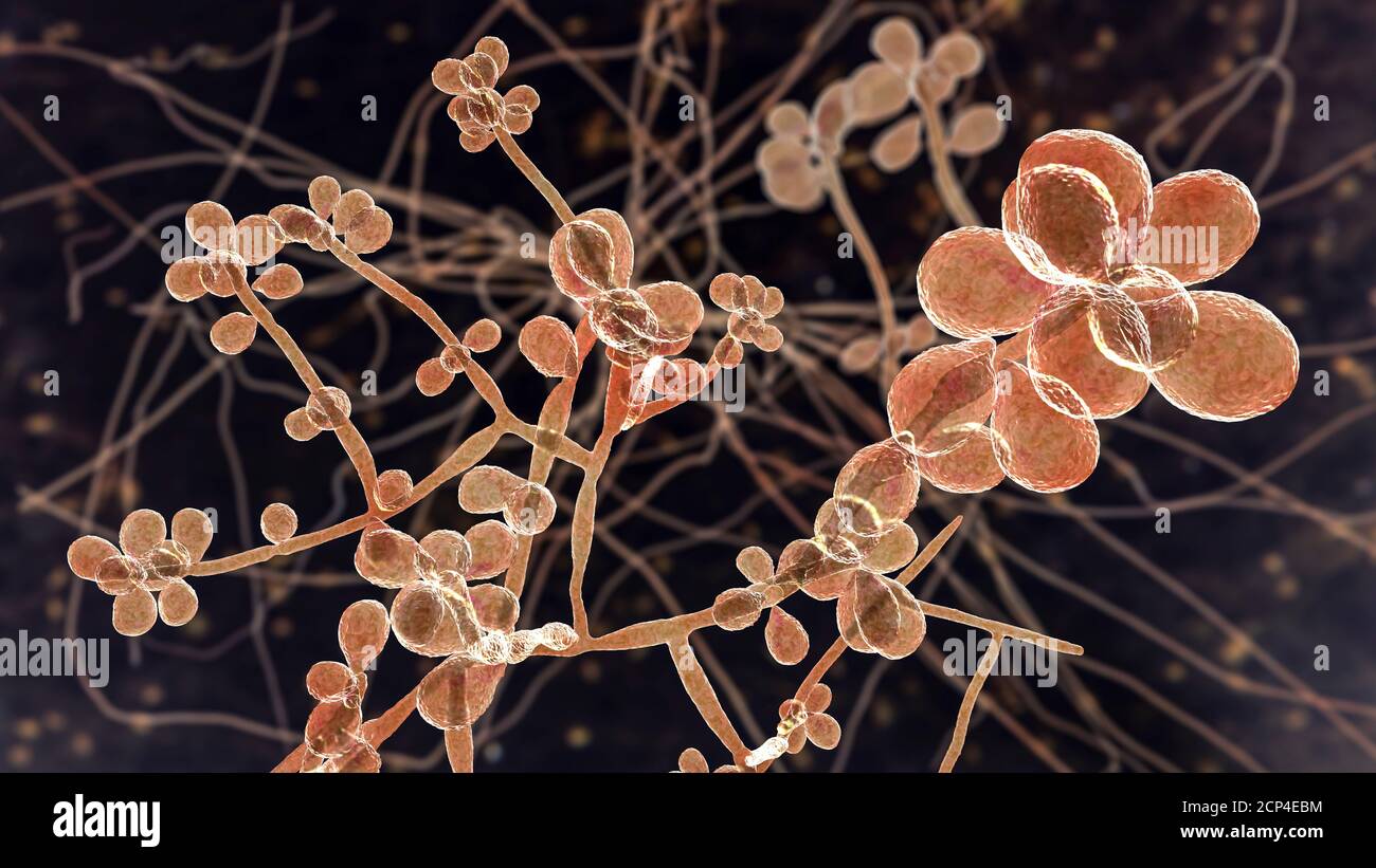 Sporotrichosis hi-res stock photography and images - Alamy