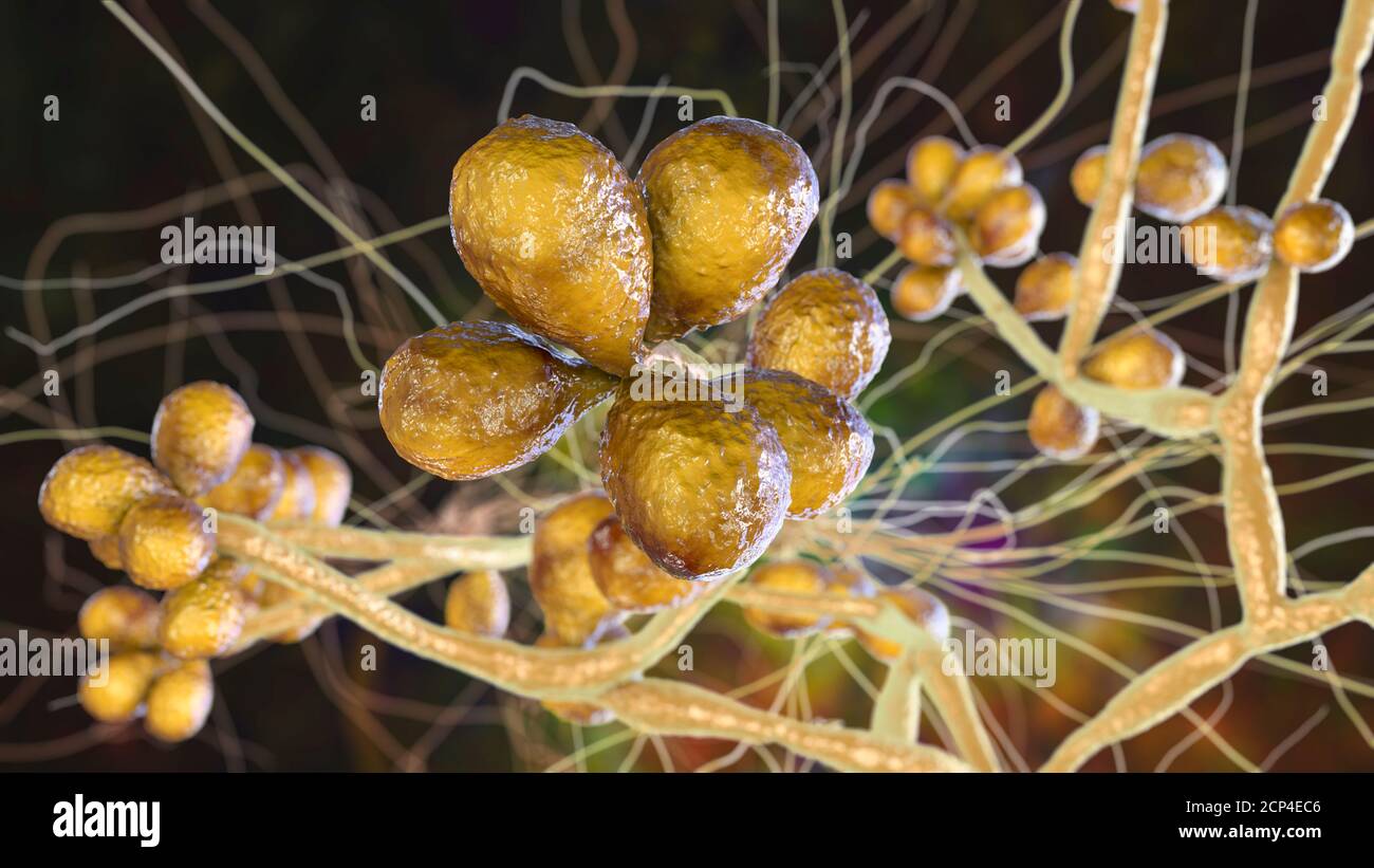 Fungus Sporothrix schenckii, causative agent of the infection ...