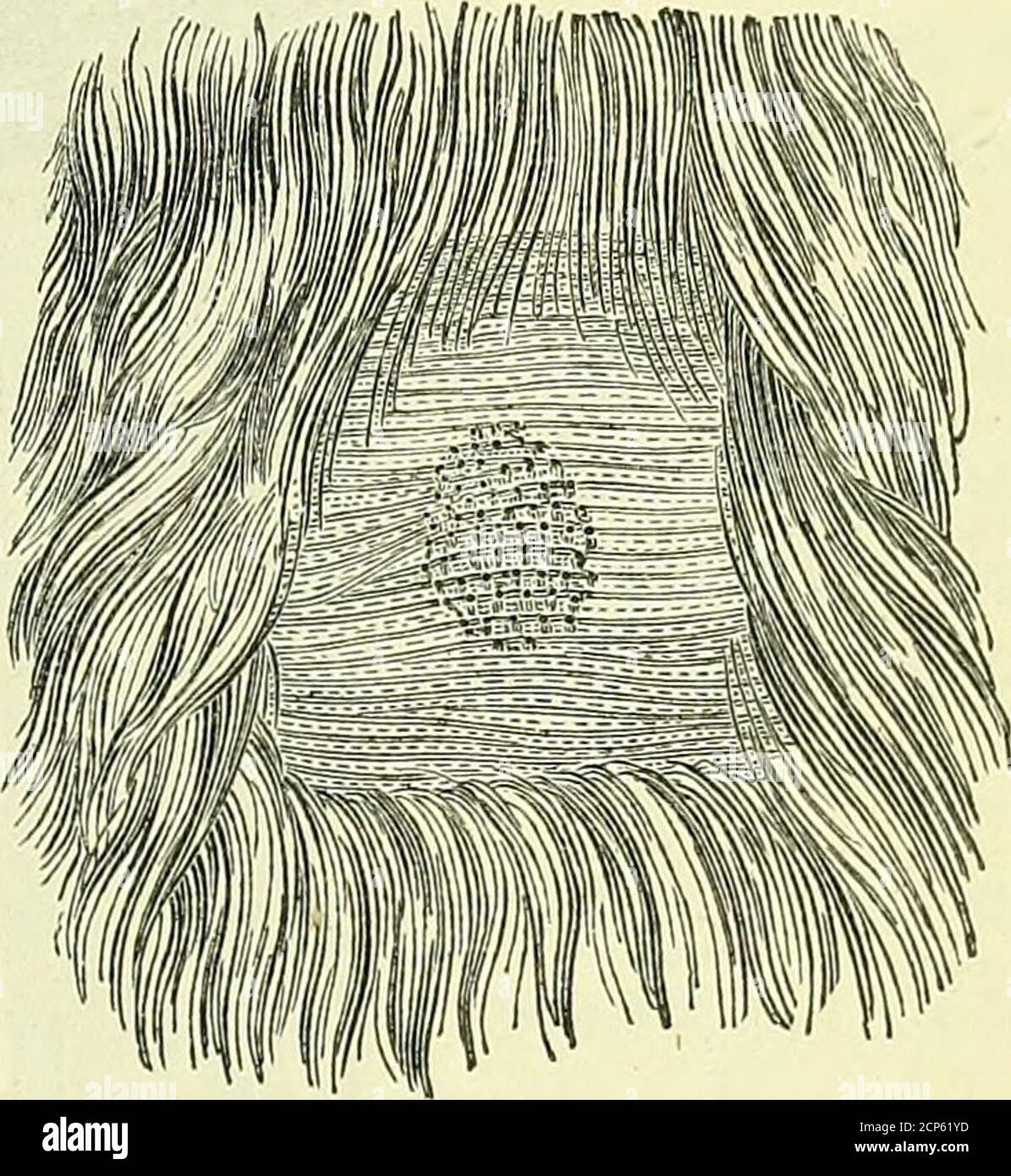 Mammary areola hi-res stock photography and images - Alamy