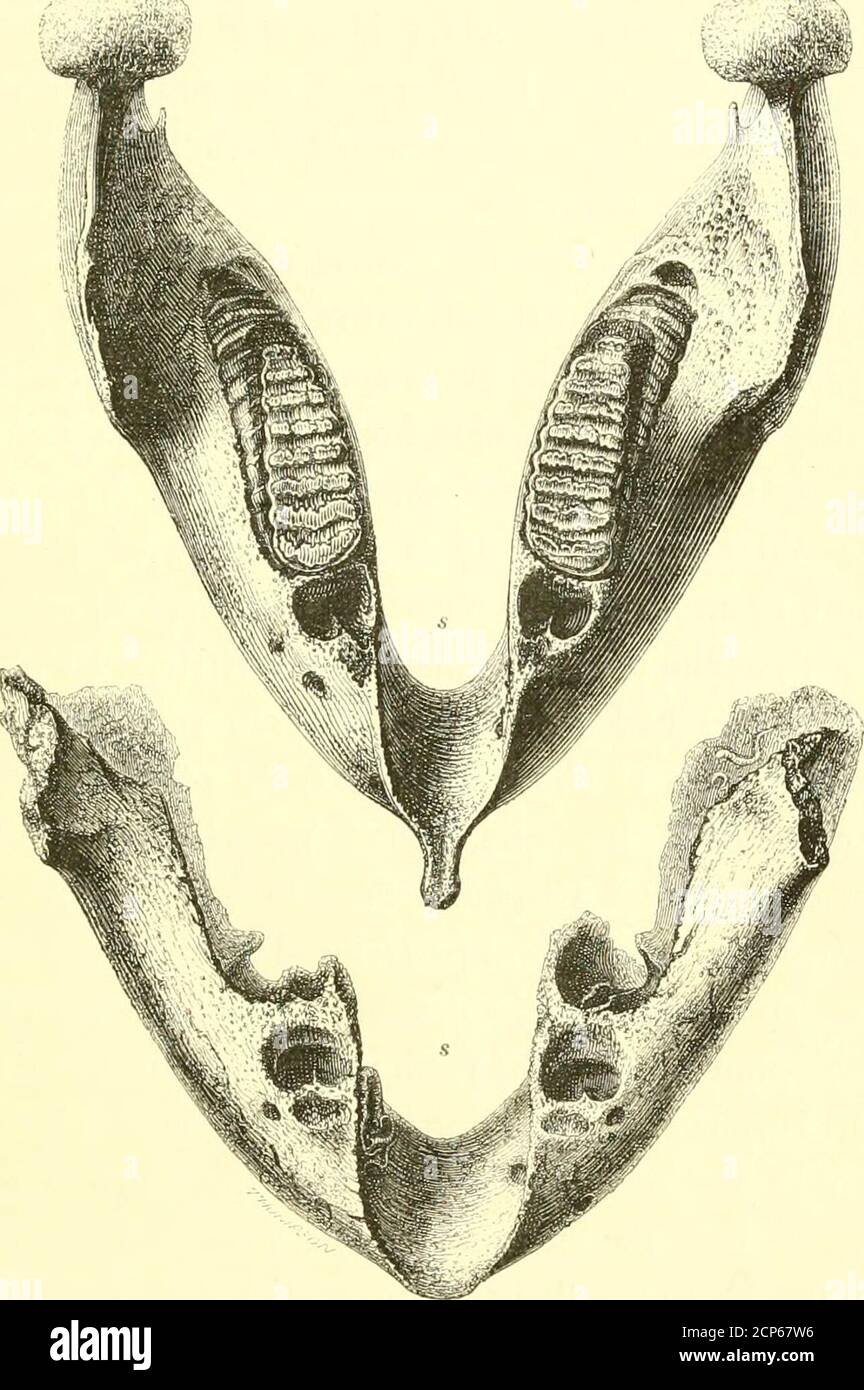 Curved zygomatic process hi-res stock photography and images - Alamy