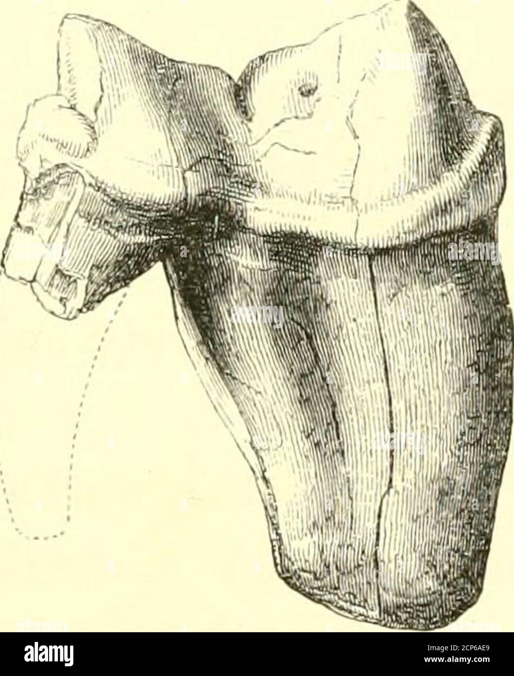 Conical tooth shape hi-res stock photography and images - Alamy