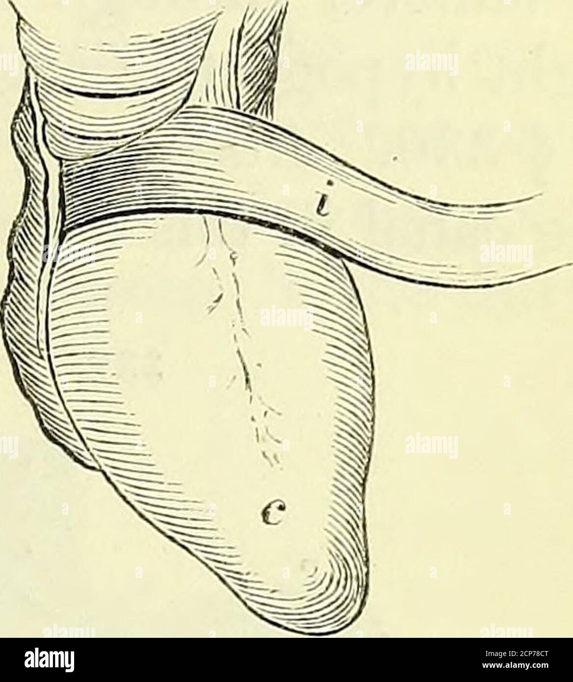 Sacculated hi-res stock photography and images - Alamy