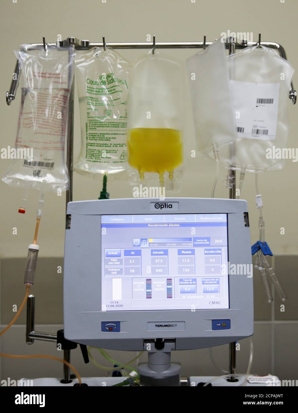 Apheresis High Resolution Stock Photography and Images - Alamy