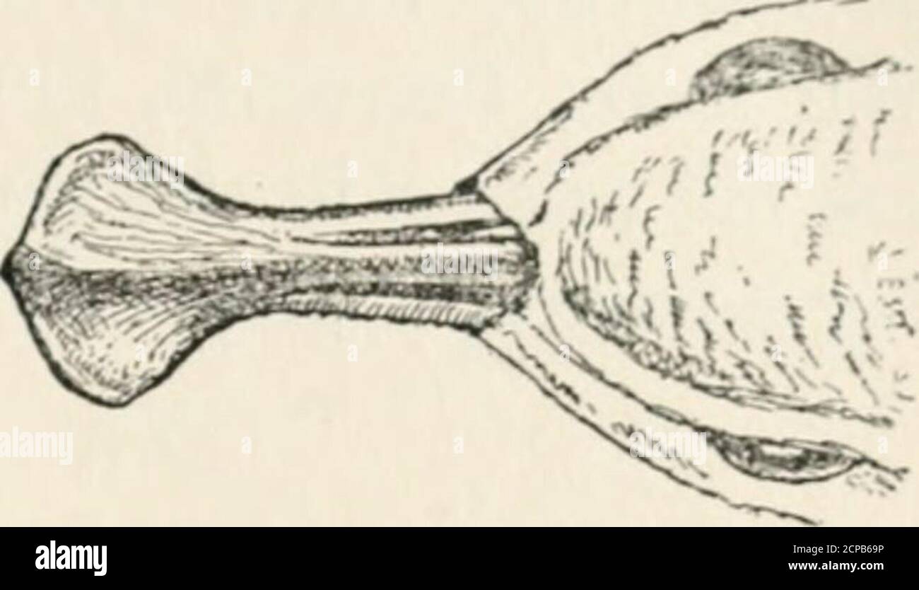 Uses bill to probe hi-res stock photography and images - Alamy