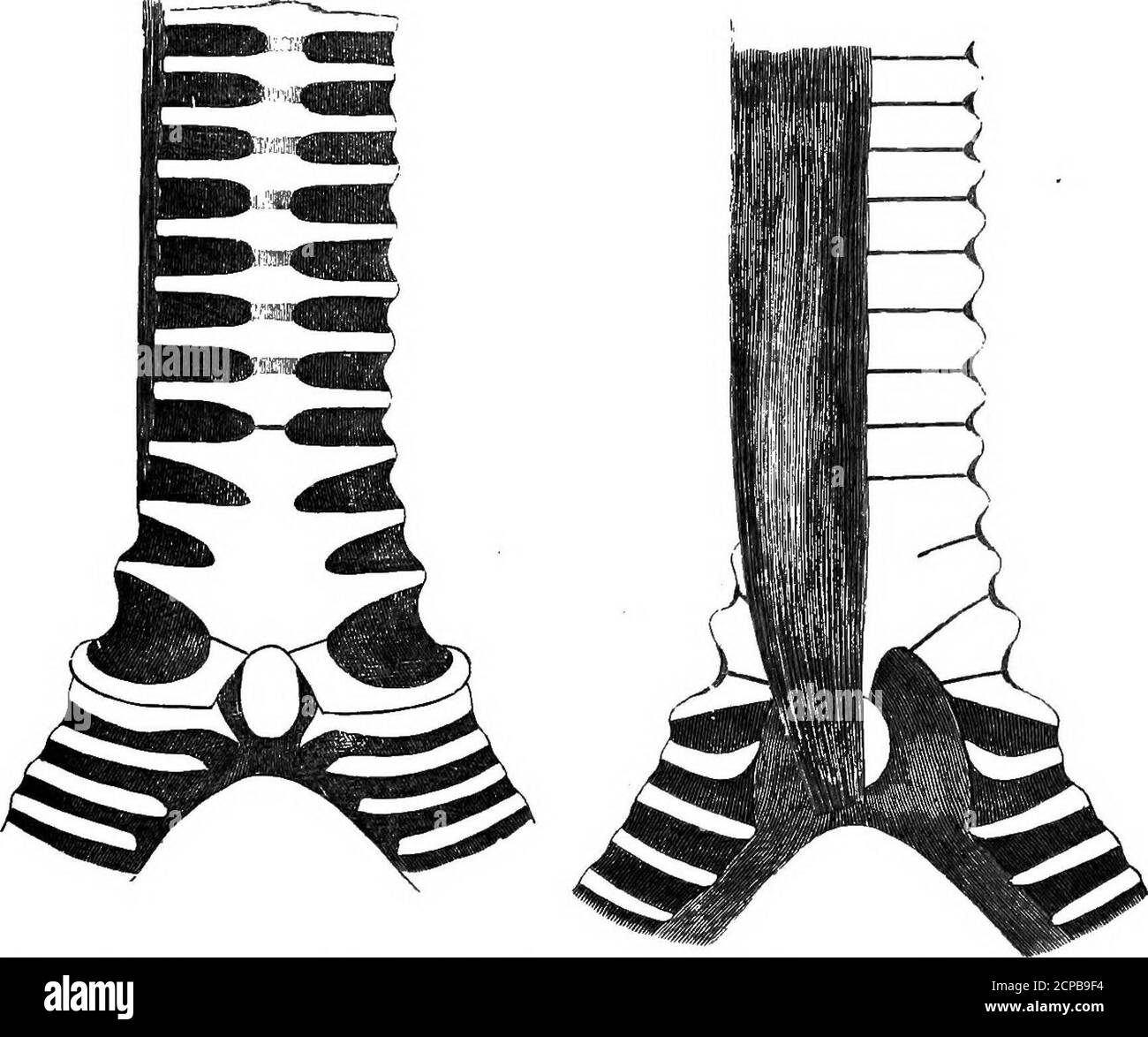 Carina of trachea Black and White Stock Photos & Images - Alamy