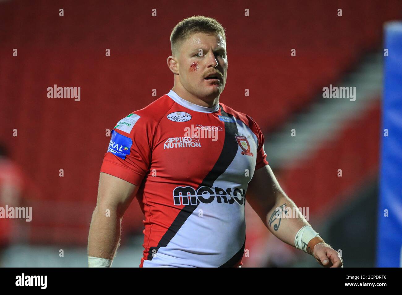 Luke Yates of Salford Red Devils receives a cut to his right cheek ...