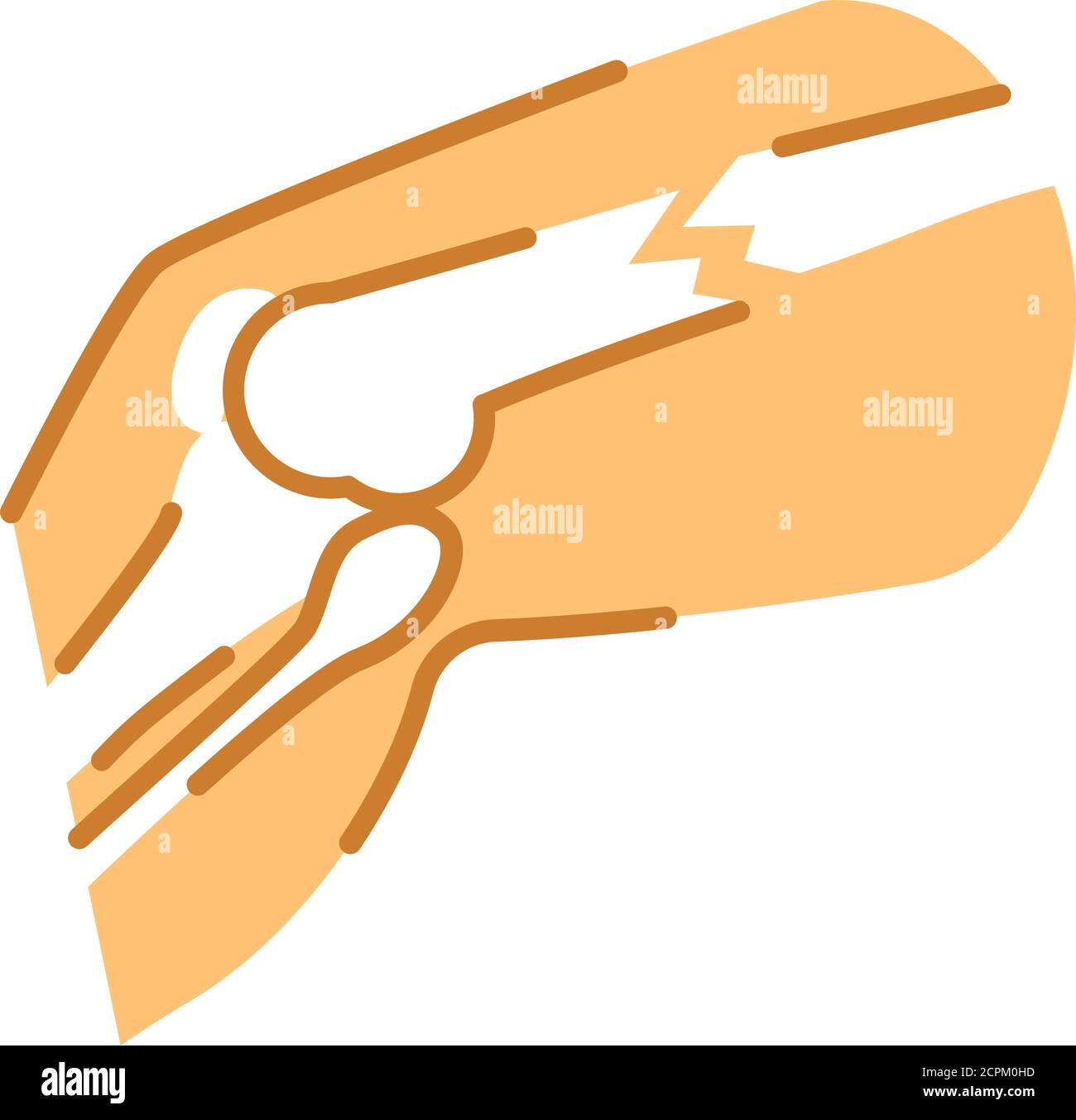 Broken leg bone flat color icon. Fracture femur concept. Sign for web ...