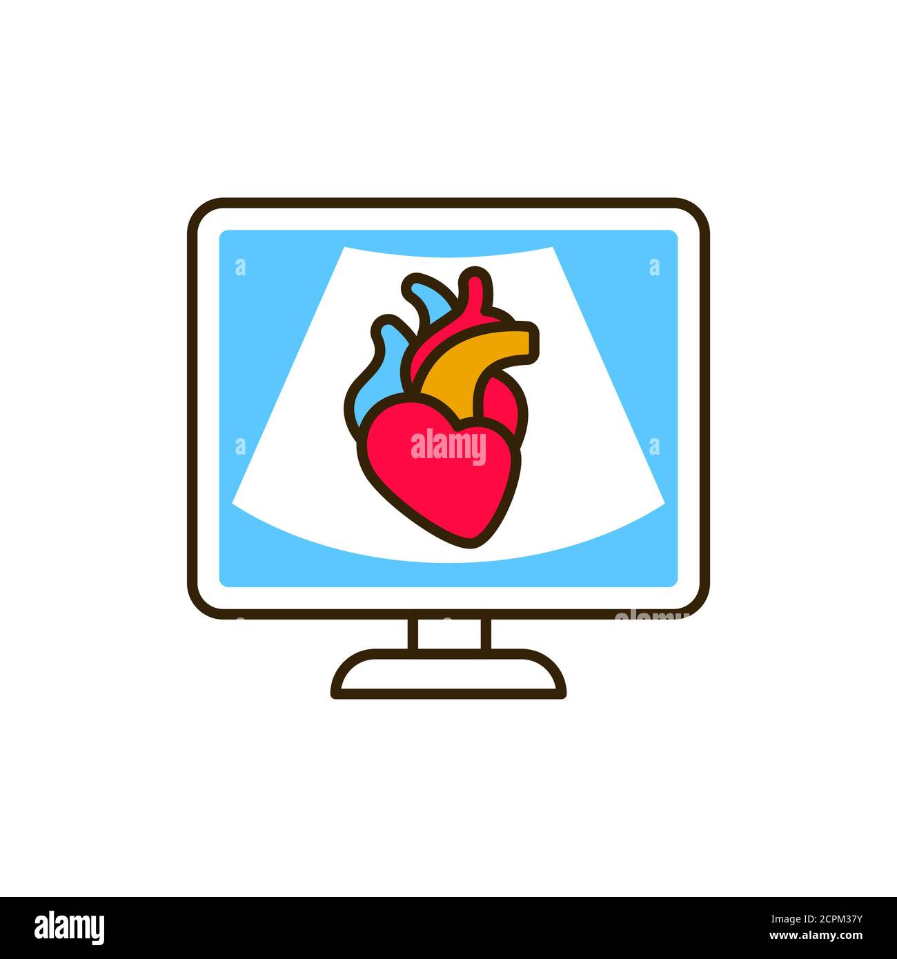 Echocardiogram hi-res stock photography and images - Alamy