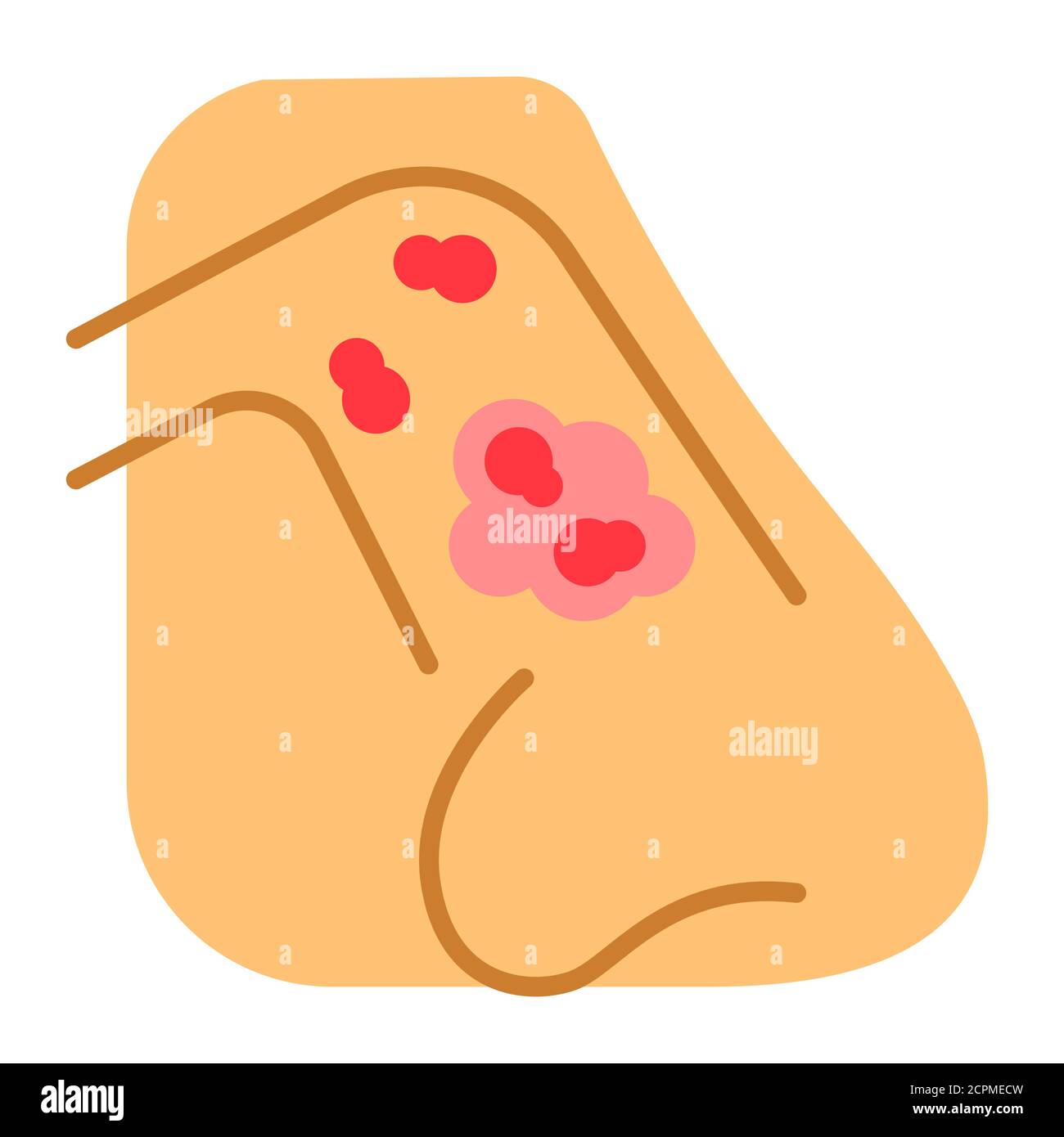 Nose Cancer Line Color Icon Human Organ Concept Malignant Neoplasm Respiratory Diseases Sign